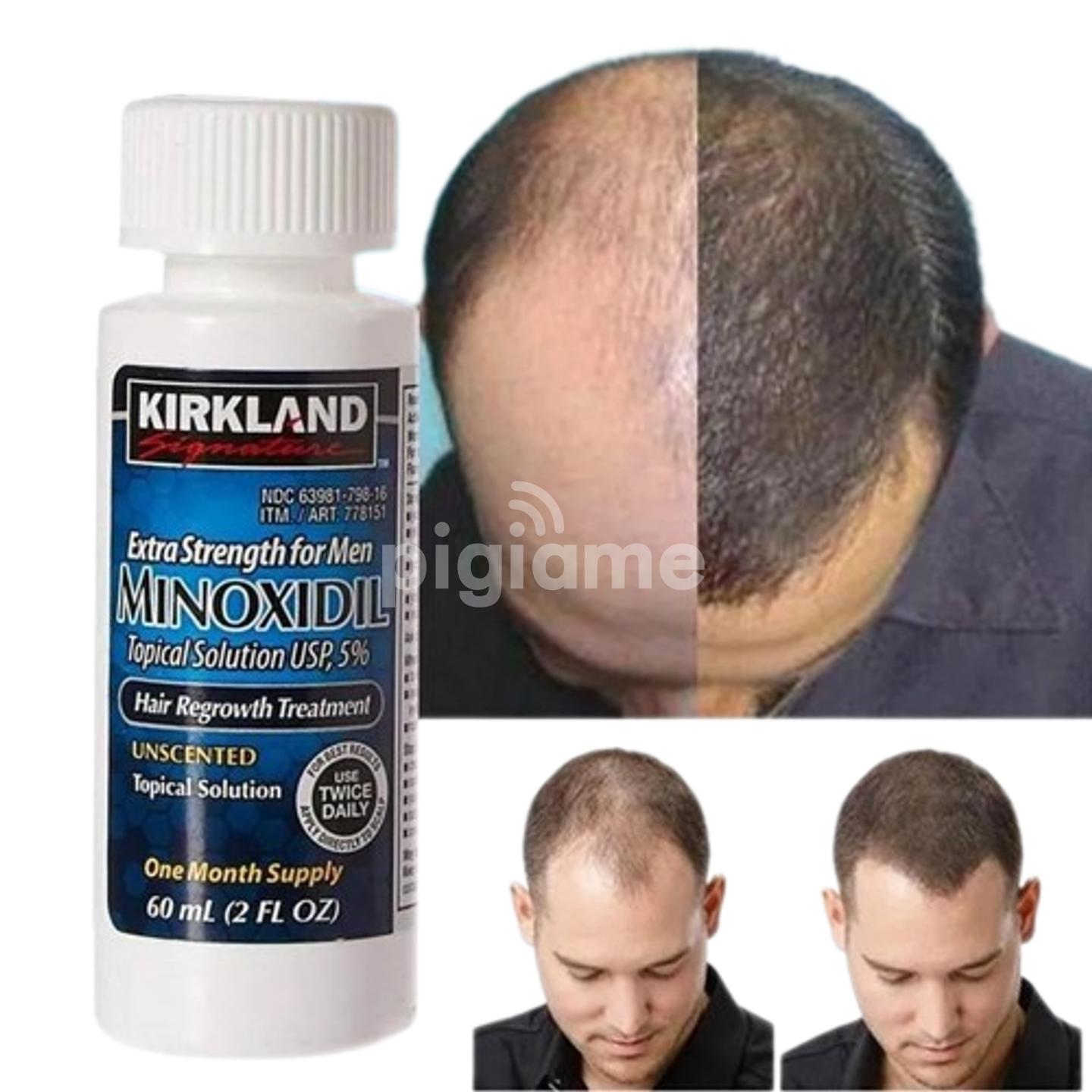 Kirkland Minoxidil For Hair Regrowth Minoxidil 5% in Nairobi CBD | PigiaMe