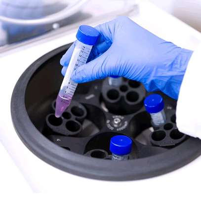 Falcon Tubes/15Ml Graduated Centrifuge Tubes Kenya in Nairobi CBD | PigiaMe