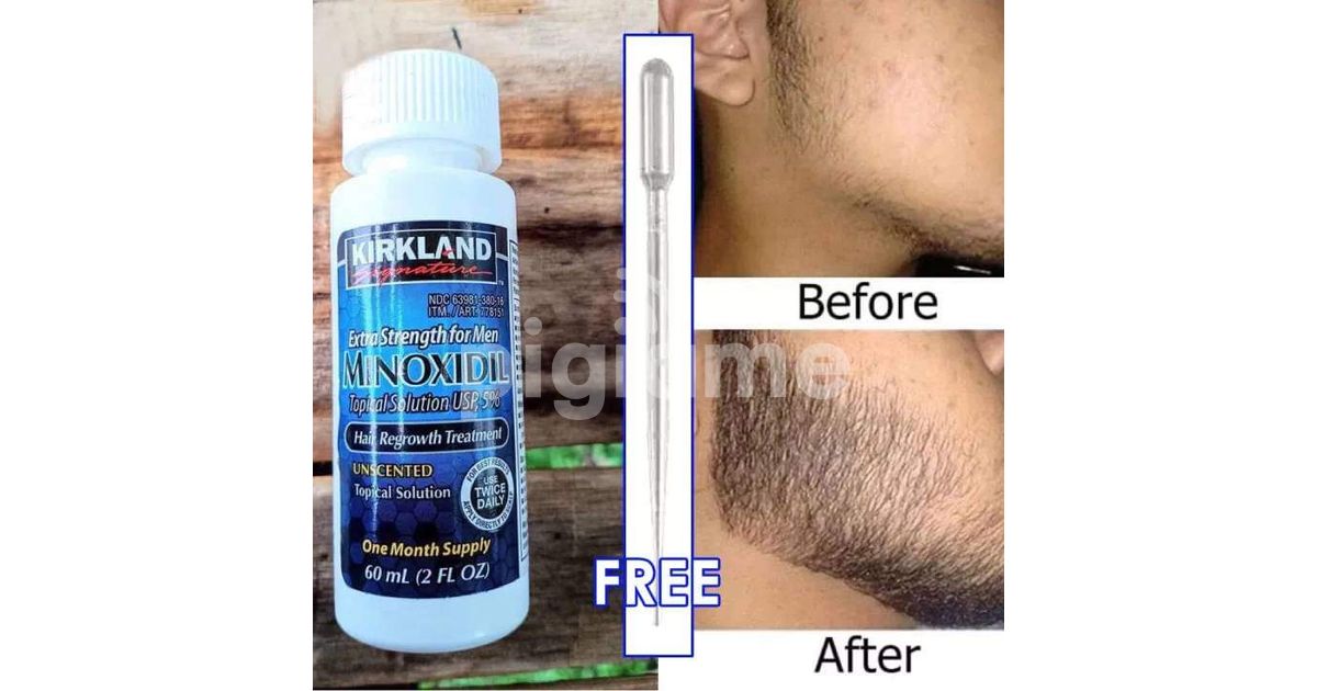 Original Kirkland Minoxidil Solution in Nairobi CBD, Tomboya Street ... Original Kirkland Minoxidil Solution in Nairobi CBD, Tomboya Street ...